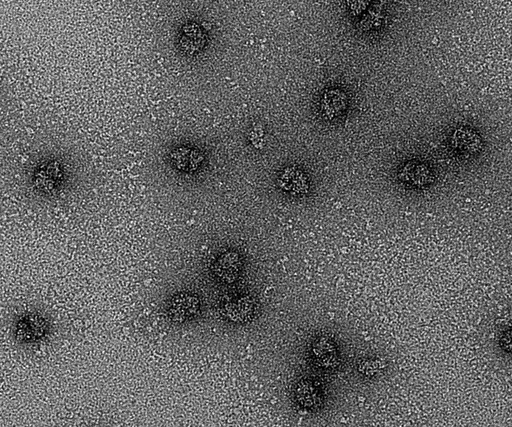 Research – Filbin Research Lab